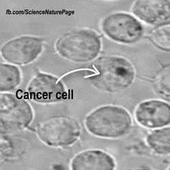cancer cells GIF - GIF Animado | MISTERGIF
